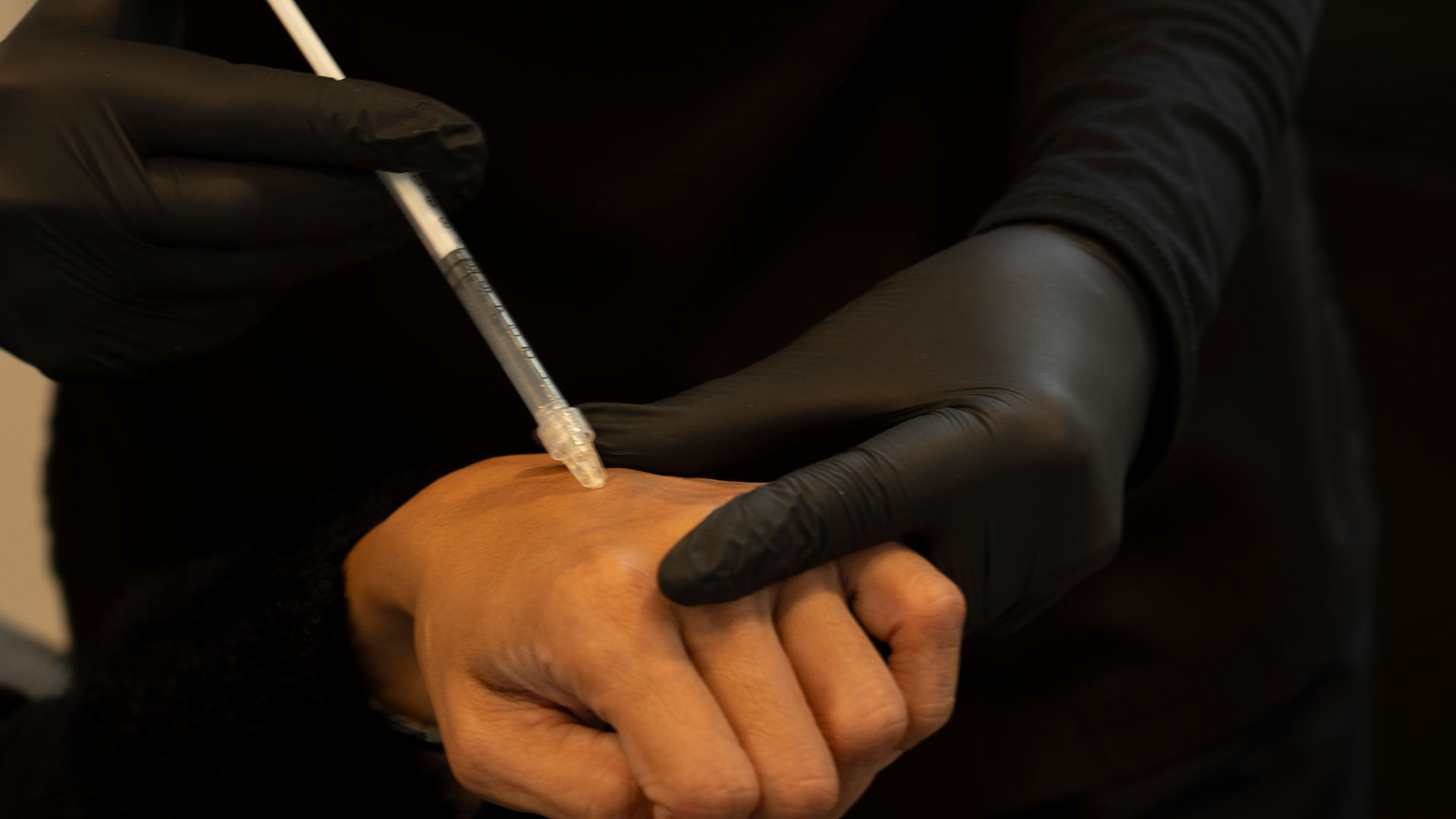 Hand Rejuvenation : Restore Youthful Hands | Skin Medical